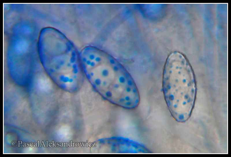 Trichophaea_pseudogregaria